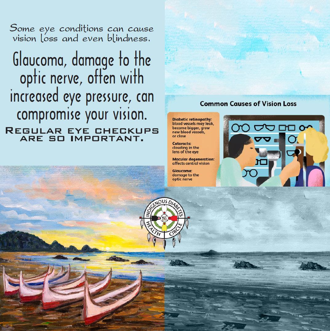 Some eye conditions can cause vision loss and even blindness. – IDHC