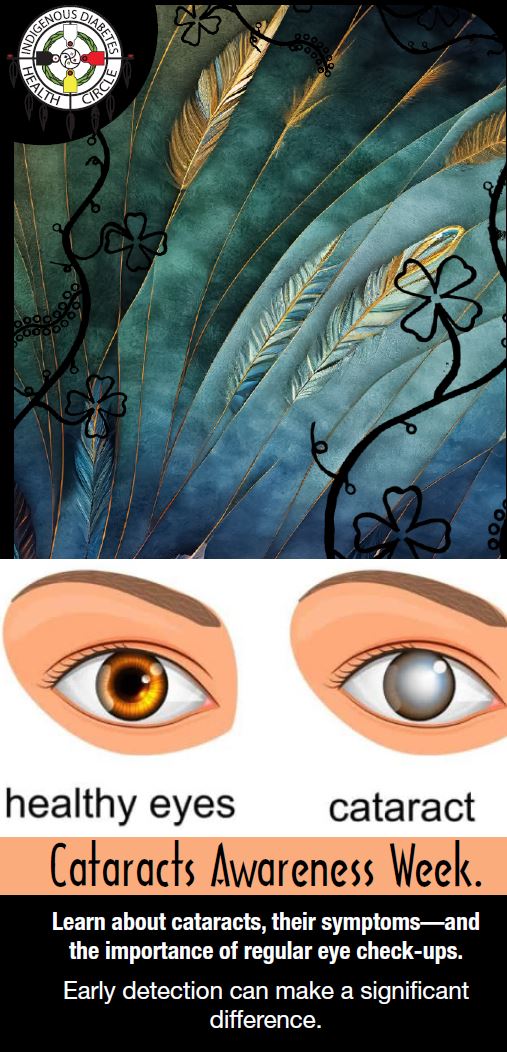 Learn about cataracts, their symptoms—and the importance of regular eye ...