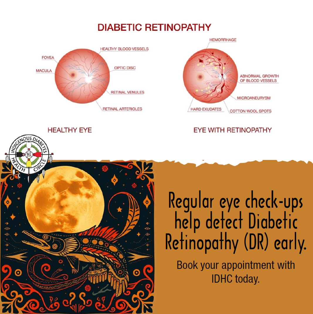 Regular eye check-ups help detect Diabetic Retinopathy (DR) early. – IDHC